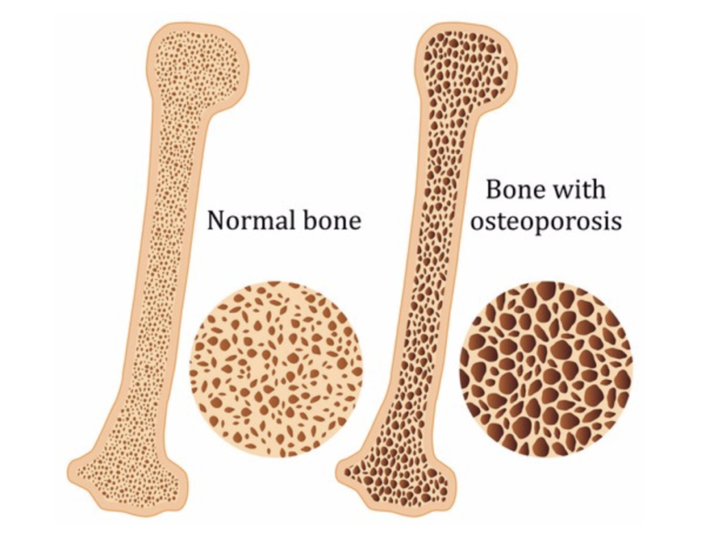 5 Essential Tips To Reboot Your Bones - Kathy Smith